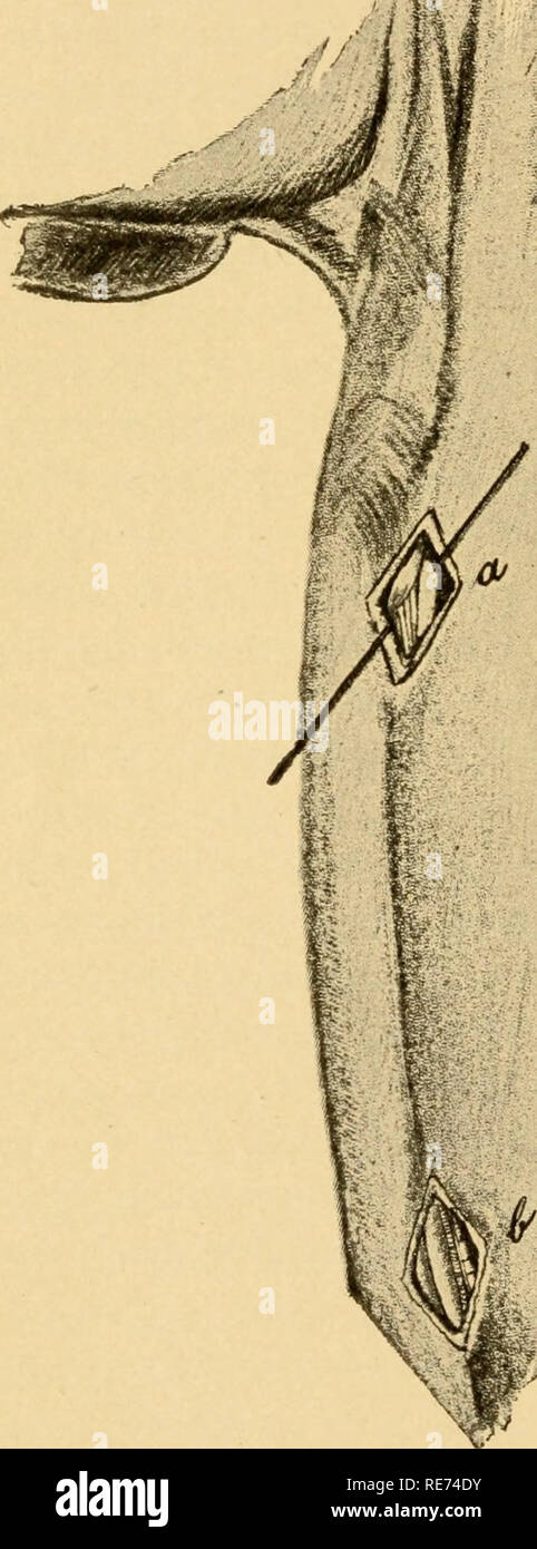 Toothed forceps hi-res stock photography and images - Alamy