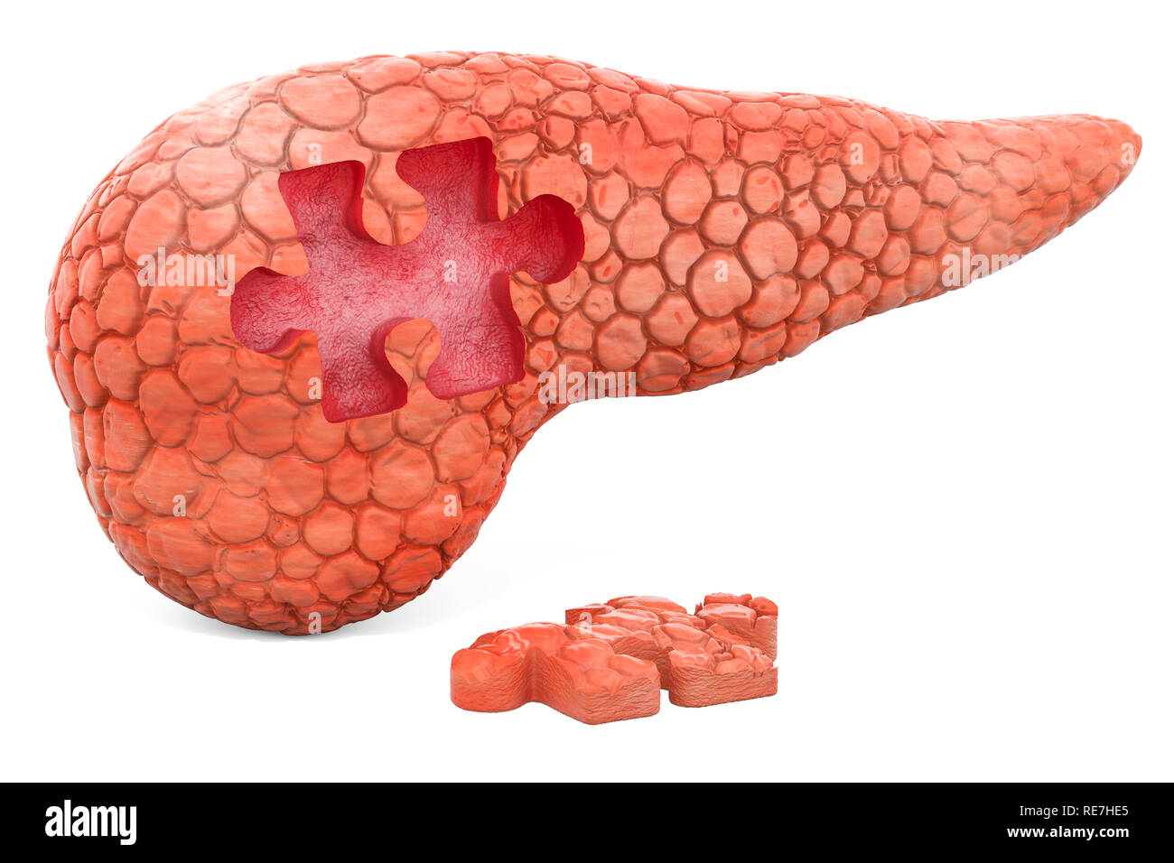 Pancreatic disease, medical concept, 3D rendering isolated on white ...