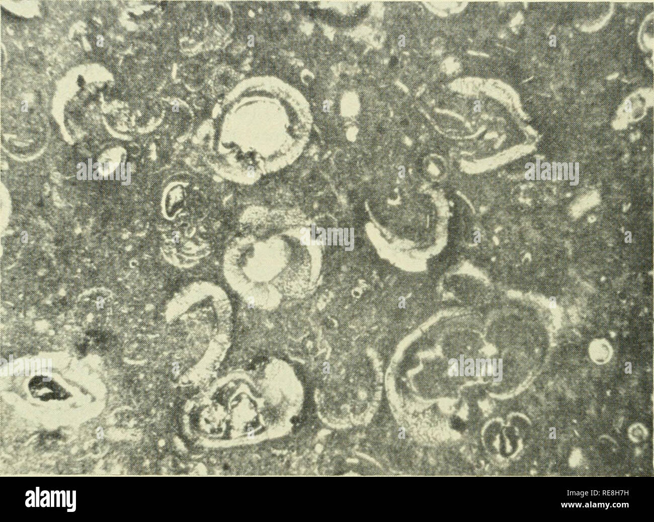 Planktonic foraminifera hi-res stock photography and images - Alamy