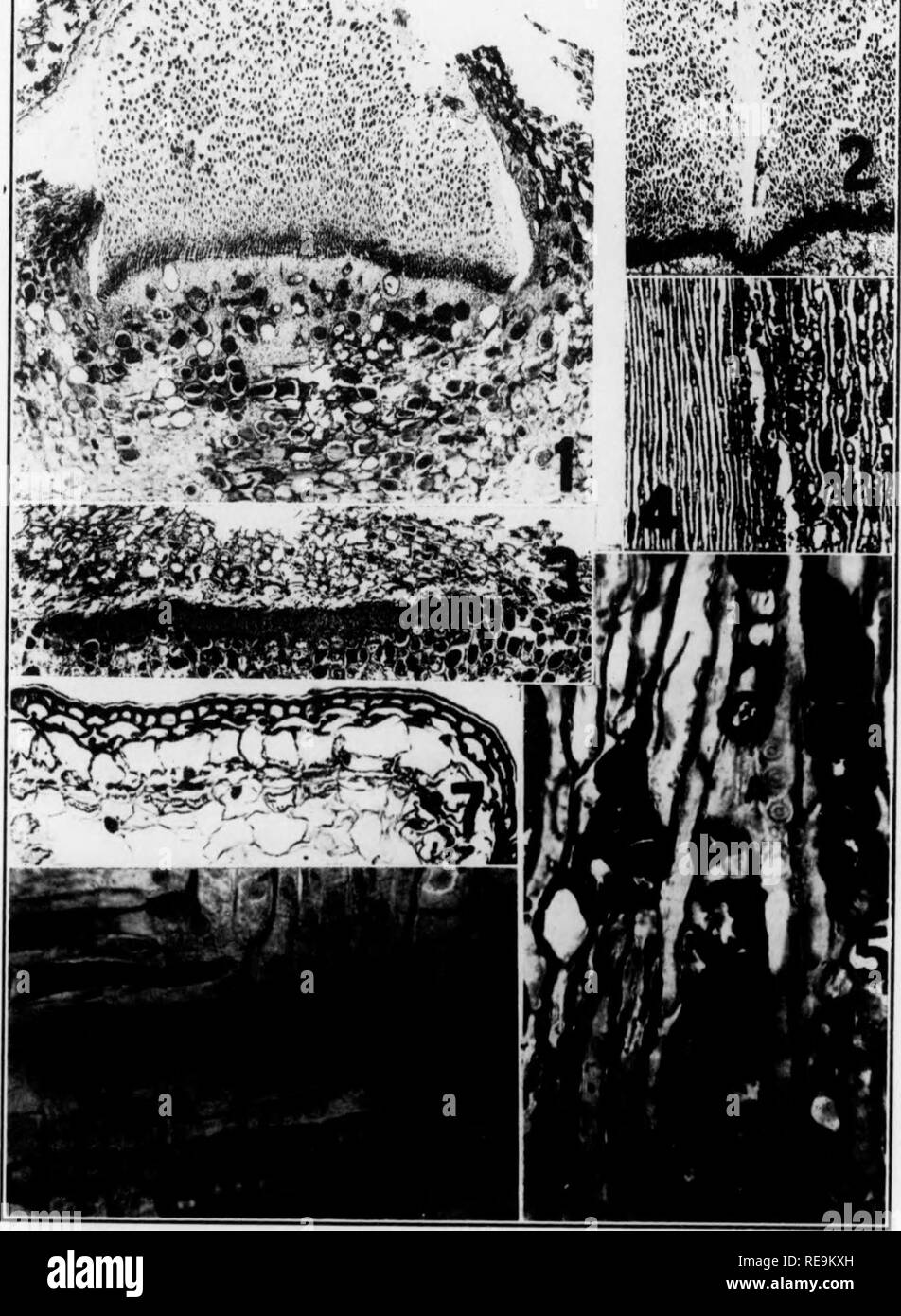 Longitudinal section of xylem tissue hi-res stock photography and ...