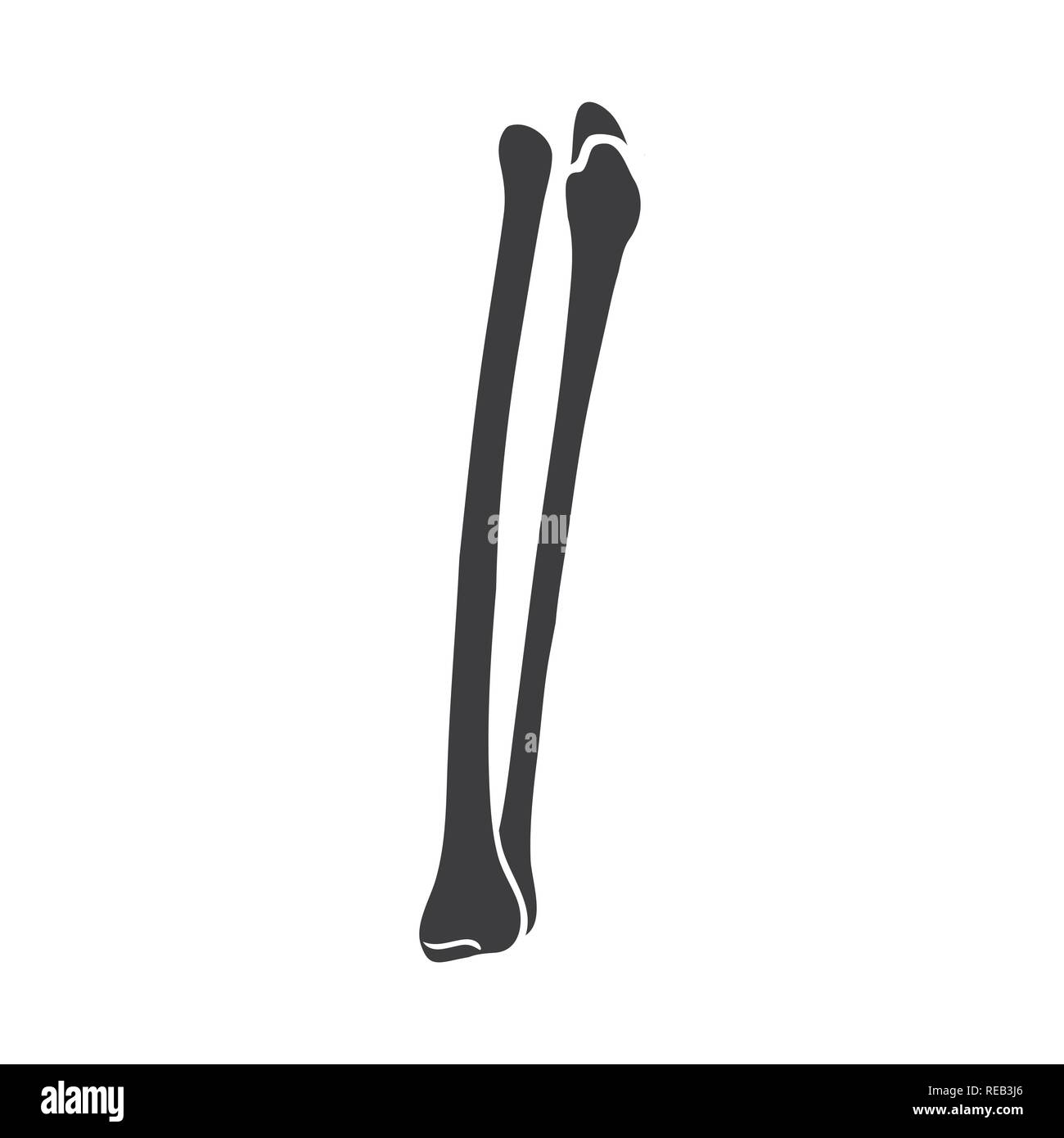 femur,leg,knee,tibia,fibula,alignment,calcium,surgery,bone,skeleton ...