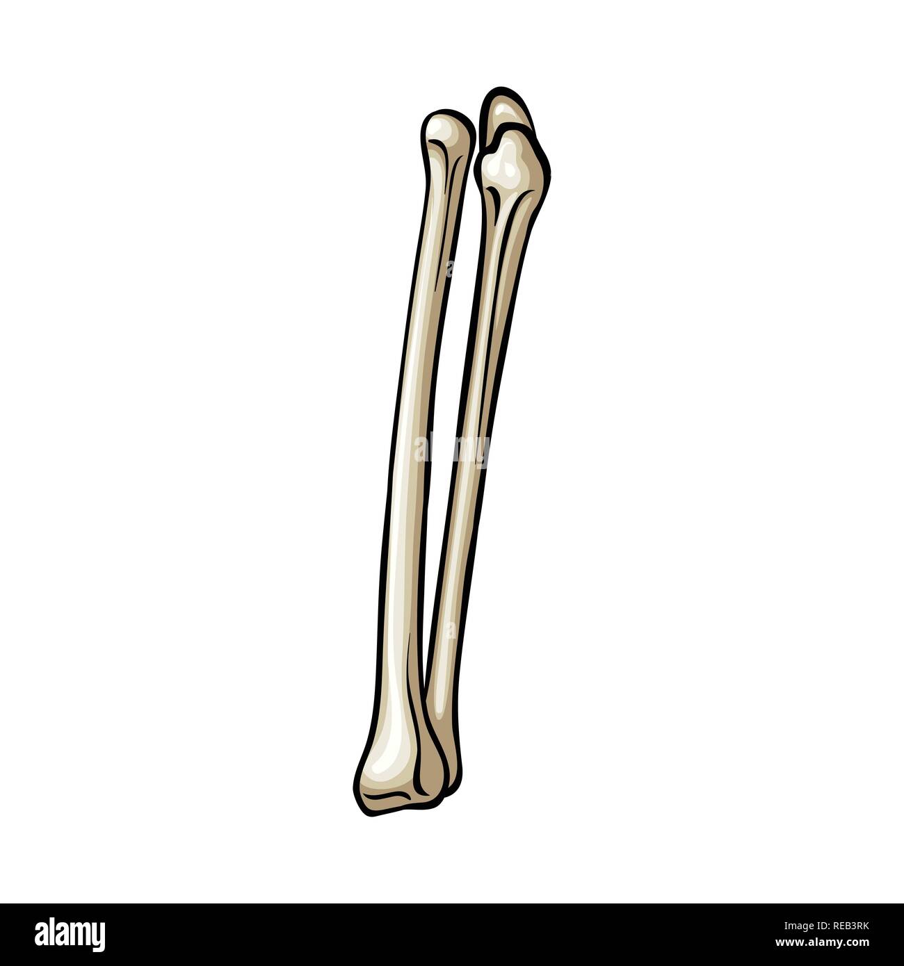 femur,leg,knee,tibia,fibula,alignment,calcium,surgery,bone,skeleton ...