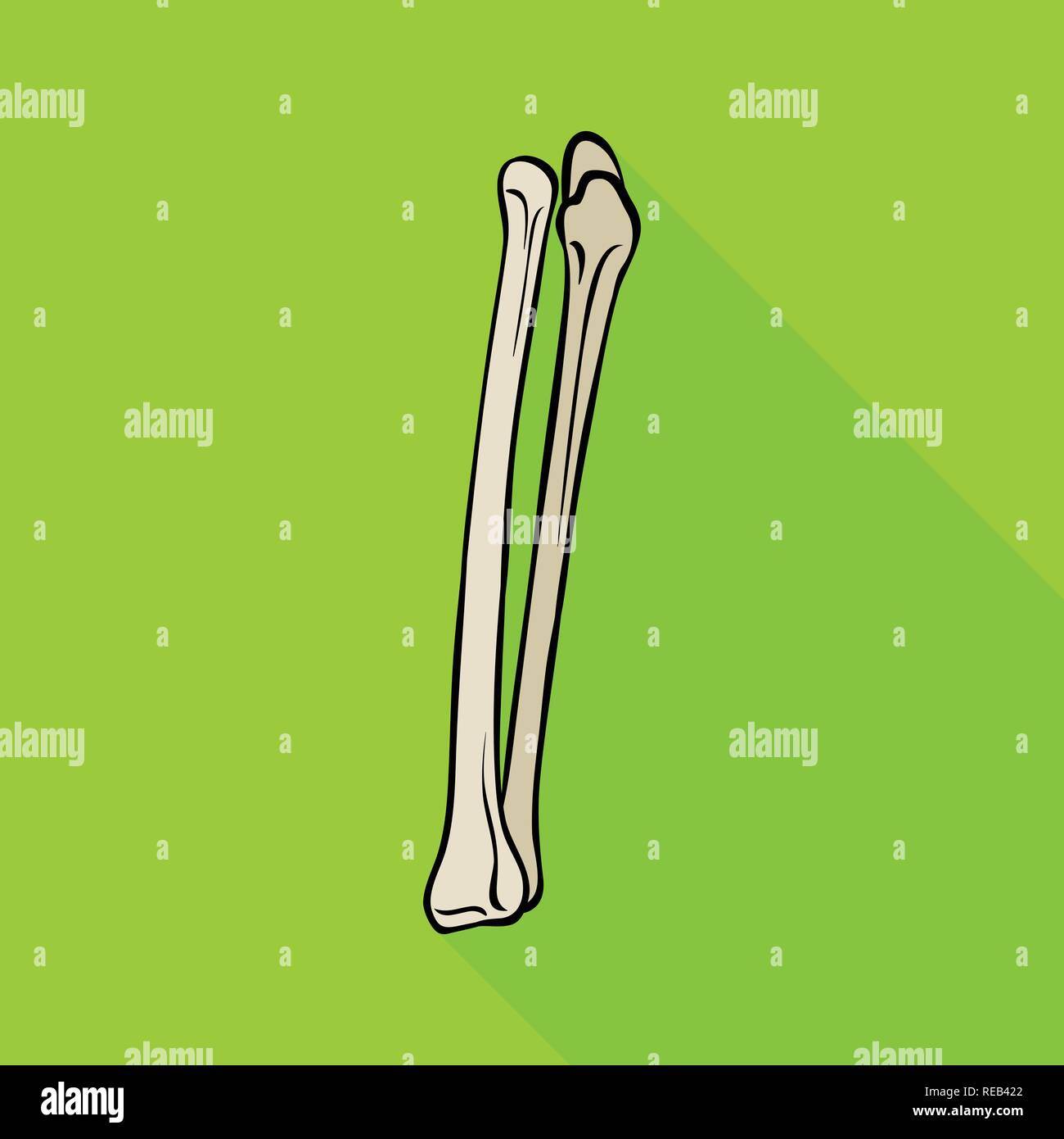 femur,leg,knee,tibia,fibula,alignment,calcium,surgery,bone,skeleton ...