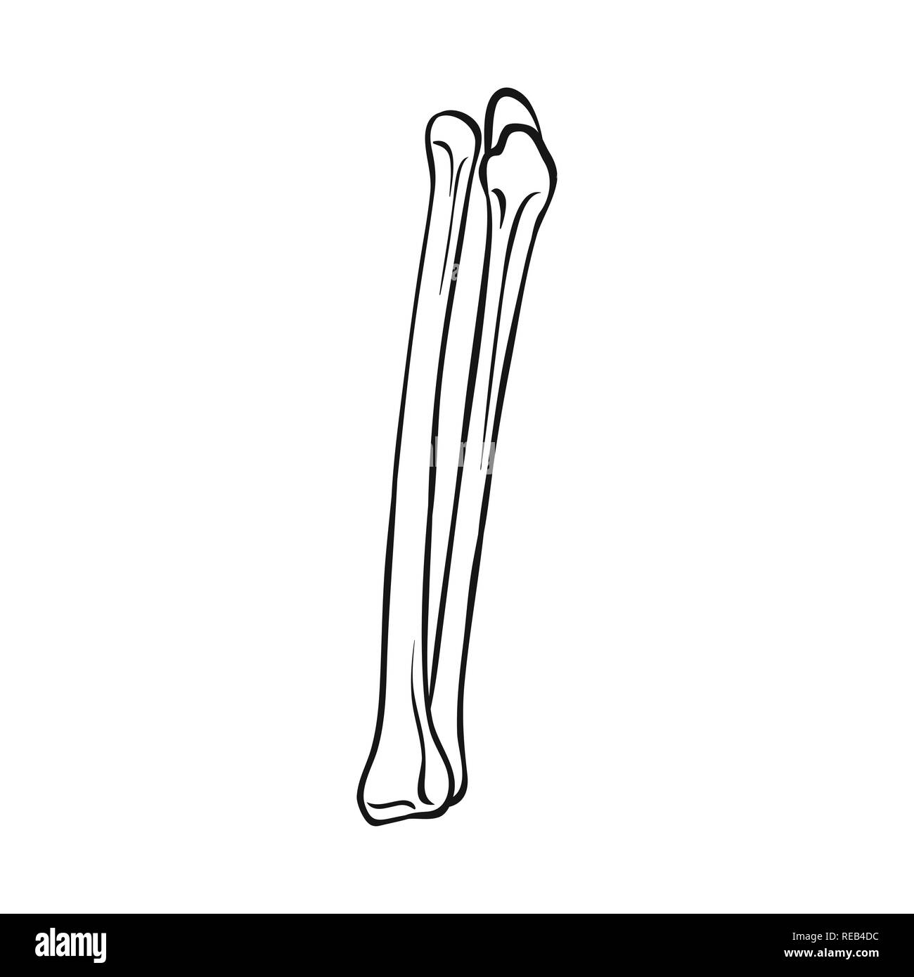 femur,leg,knee,tibia,fibula,alignment,calcium,surgery,bone,skeleton ...