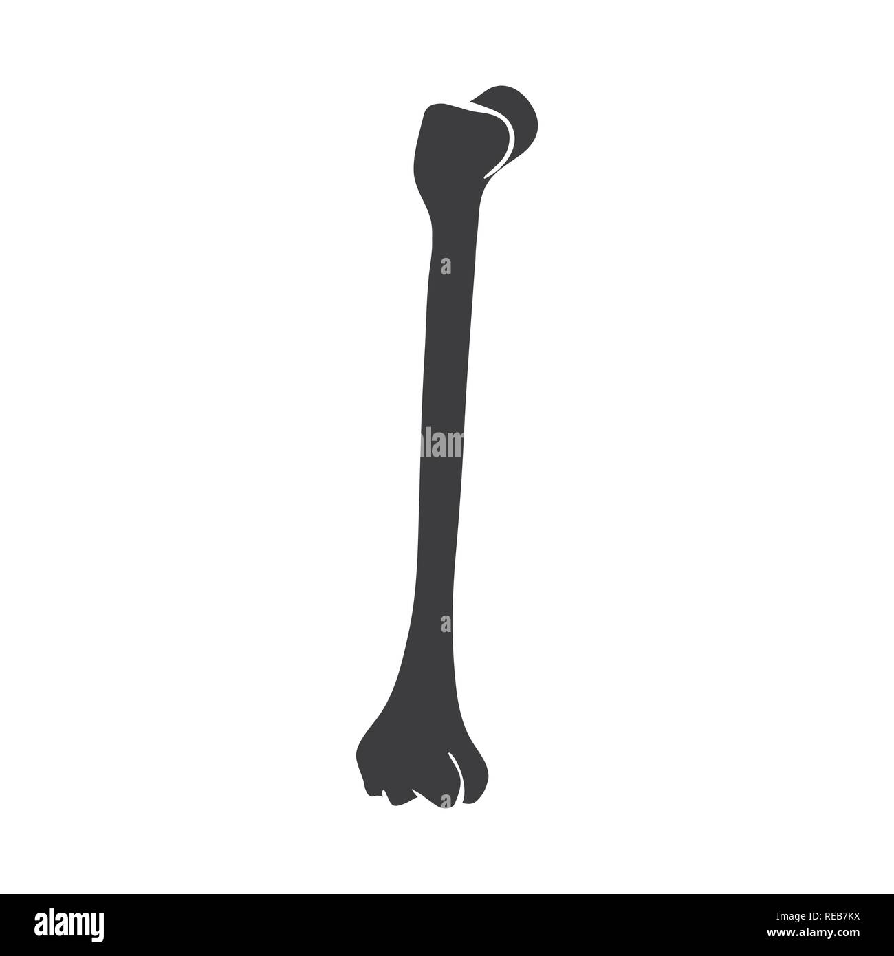 broken,fibula,shin,tibia,fracture,leg,pain,femur,surgery,bone,skeleton ...