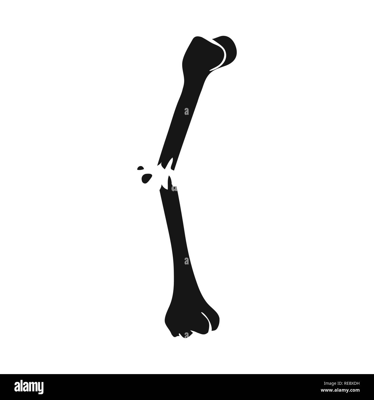 fracture,pain,bias,injury,connective,musculoskeletal,fiber,scientific ...