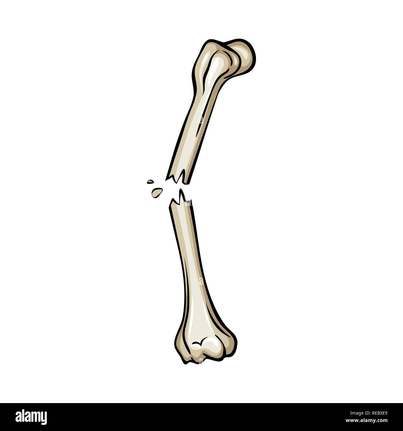 fracture,pain,bias,injury,connective,musculoskeletal,fiber,scientific ...