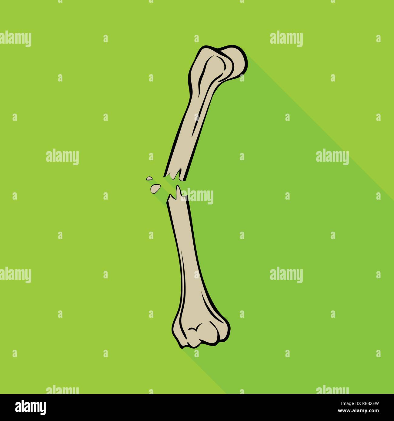 fracture,pain,bias,injury,connective,musculoskeletal,fiber,scientific ...