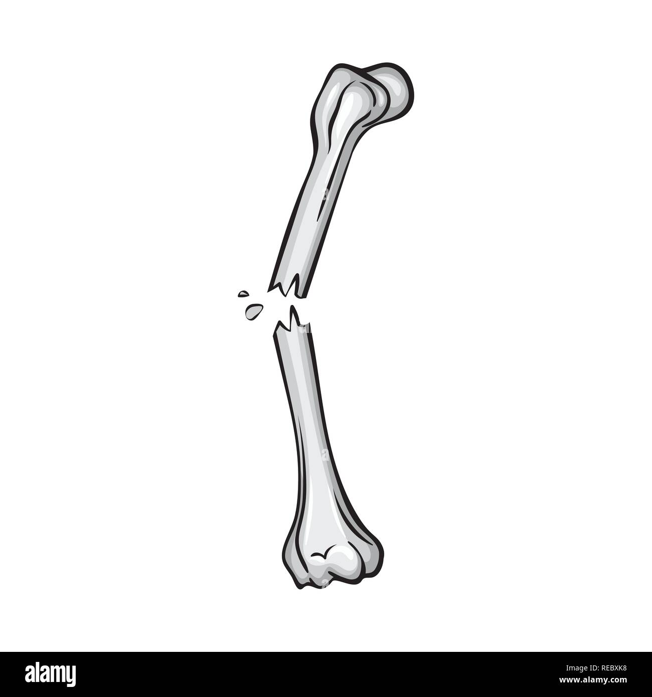 fracture,pain,bias,injury,connective,musculoskeletal,fiber,scientific ...