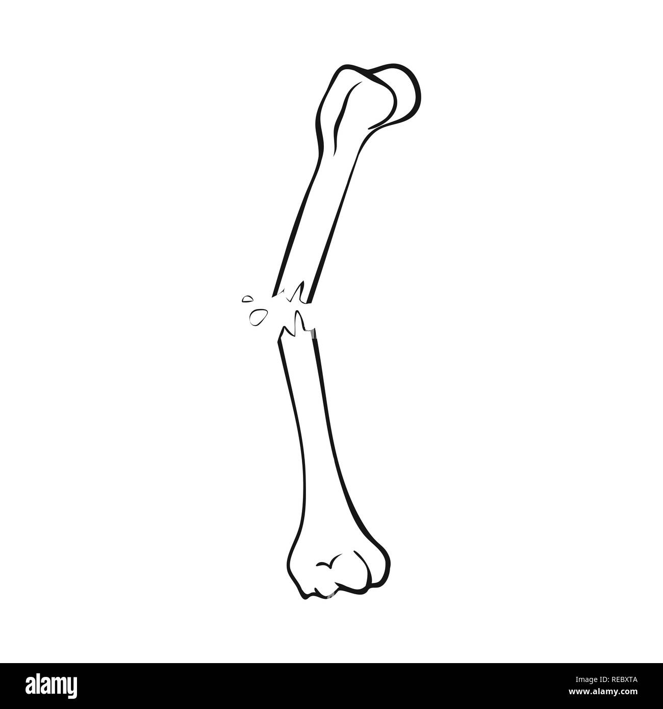 fracture,pain,bias,injury,connective,musculoskeletal,fiber,scientific ...