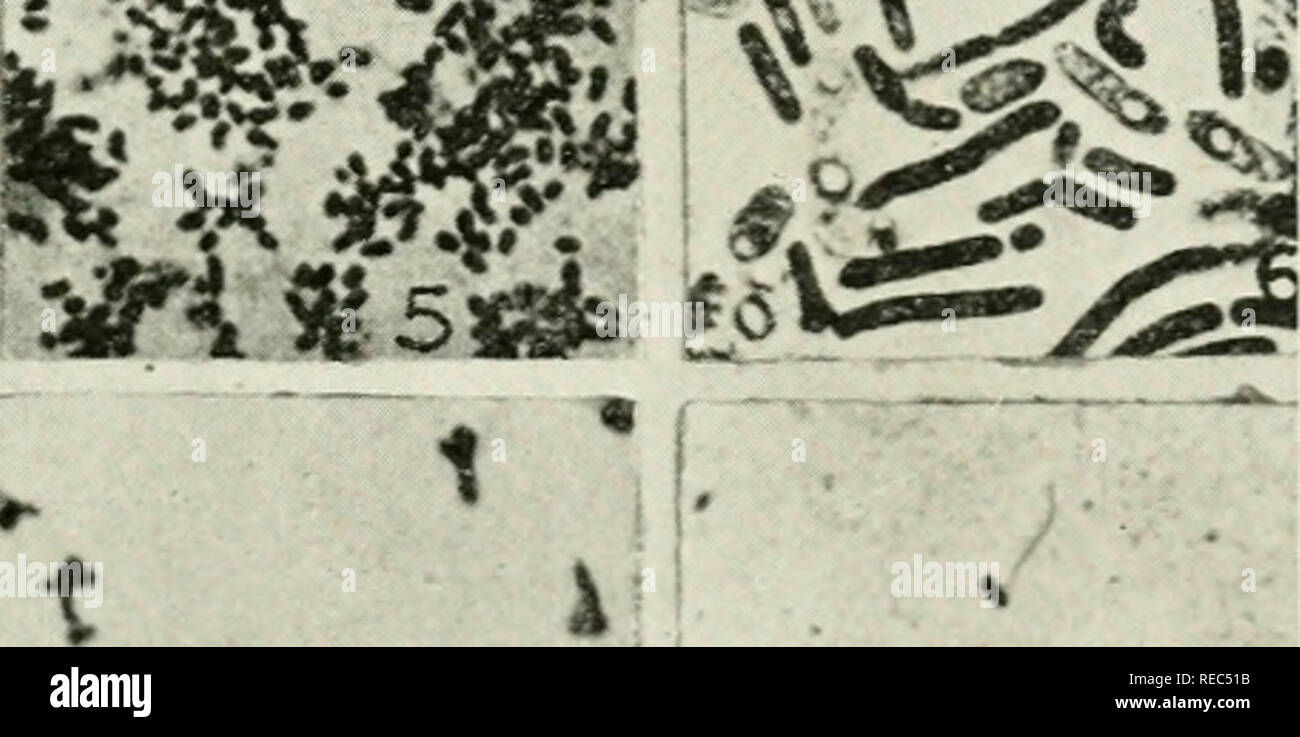 Nitrosomonas Bacteria