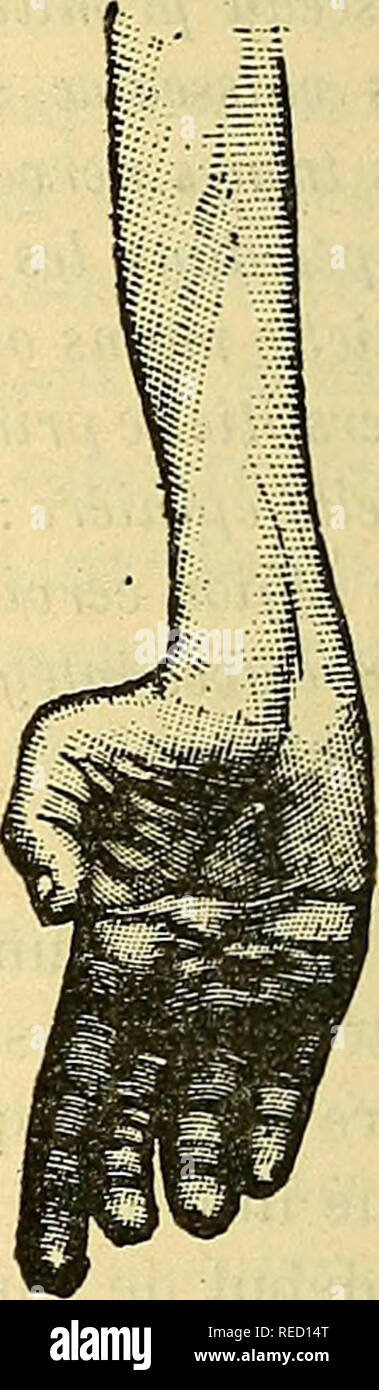 Griffe des mains hi-res stock photography and images - Alamy