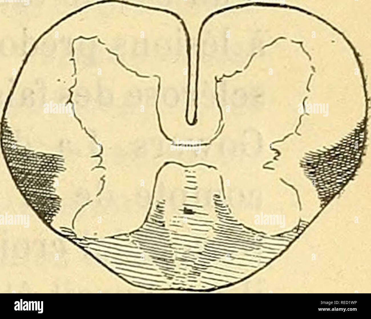 Corne dorsale hi-res stock photography and images - Alamy