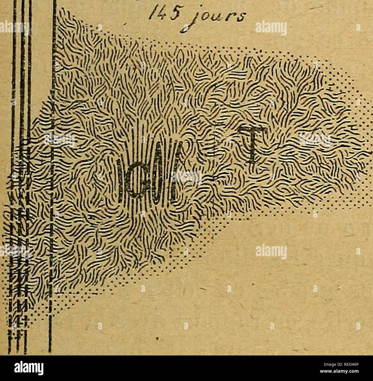 Nevus formation hi-res stock photography and images - Alamy