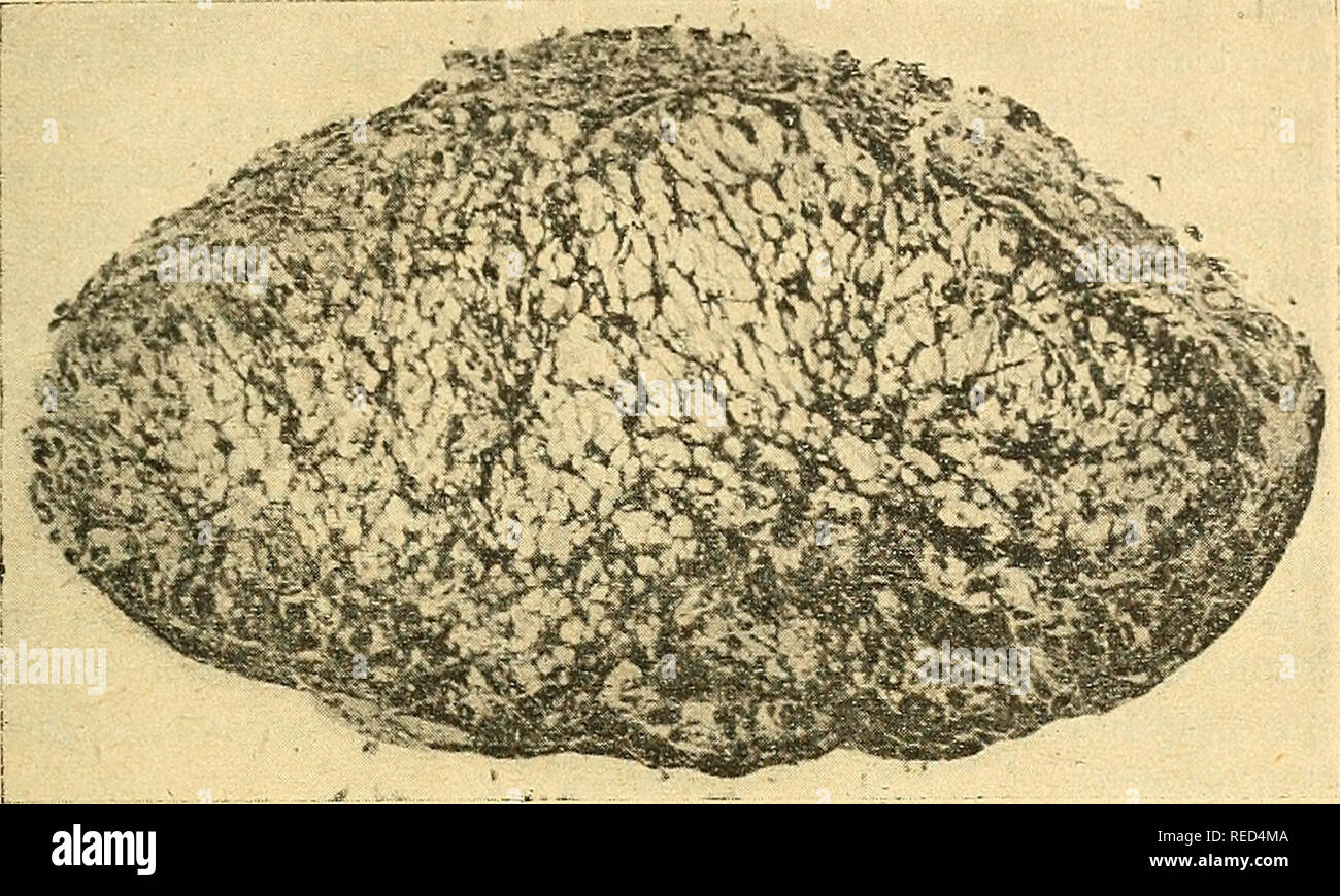 Tissu nerveux hi-res stock photography and images - Alamy