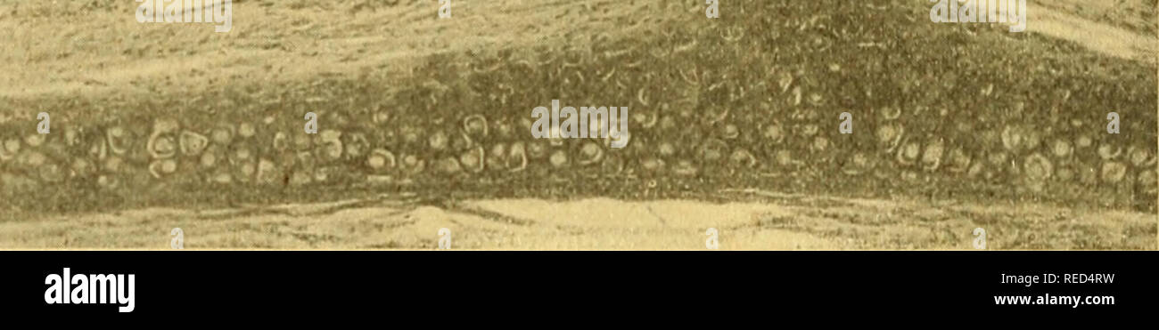 Cartilage de l'oreille hi-res stock photography and images - Alamy