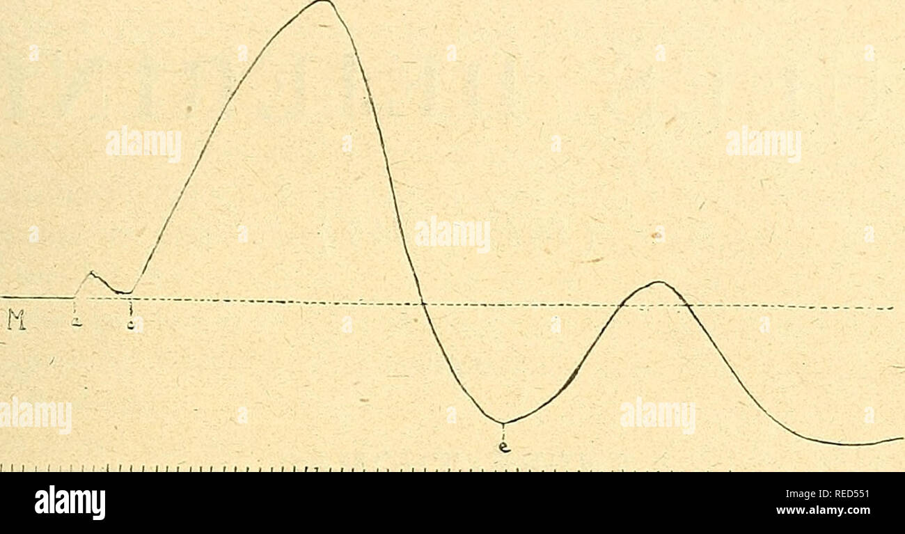 Hypotonique hi-res stock photography and images - Alamy