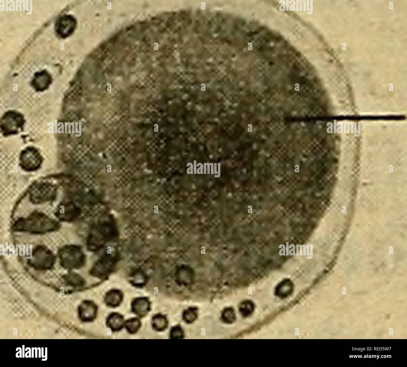 Plasmazelle hi-res stock photography and images - Alamy