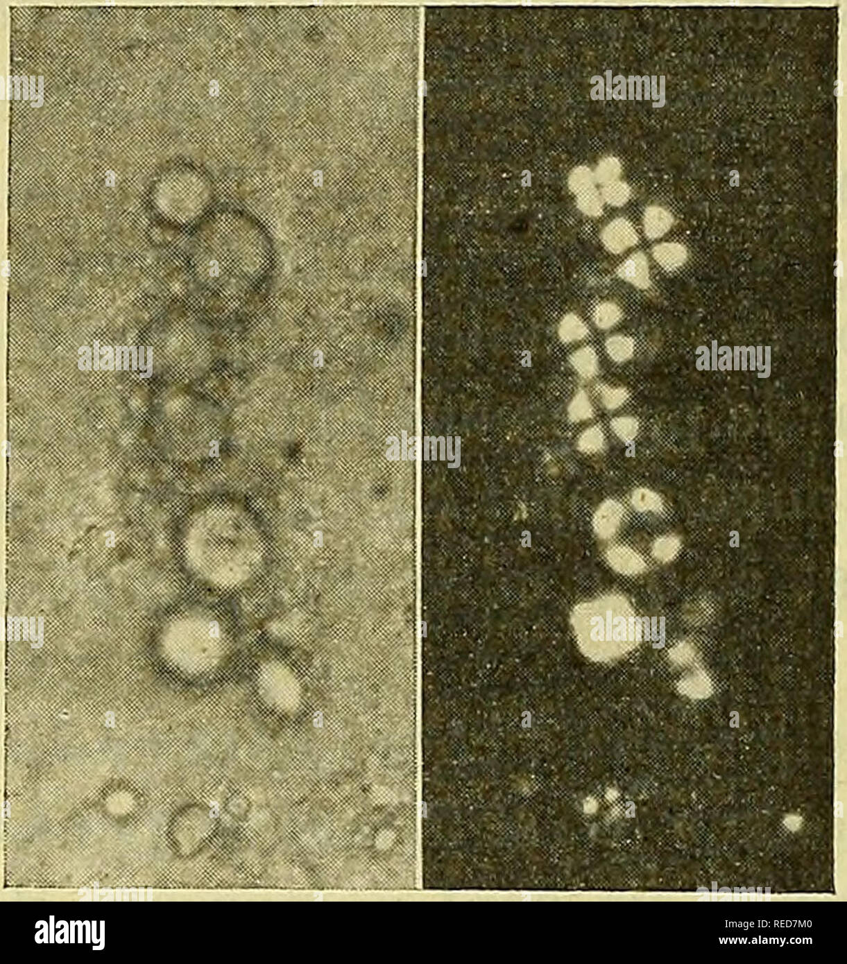 Gránulo gránulo hi-res stock photography and images - Alamy