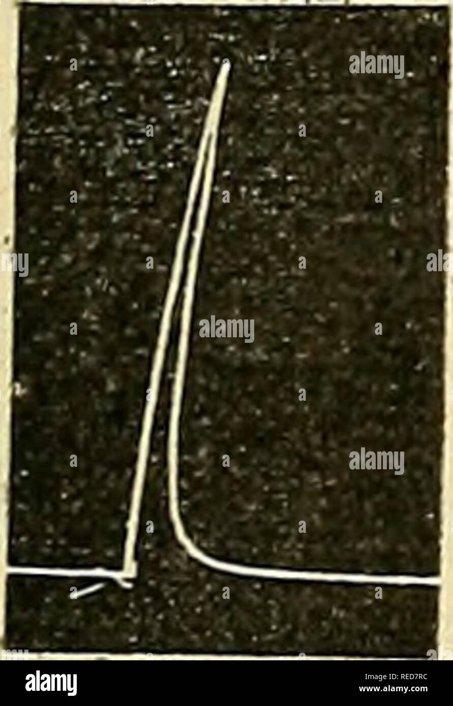 Nerf péronier hi-res stock photography and images - Alamy