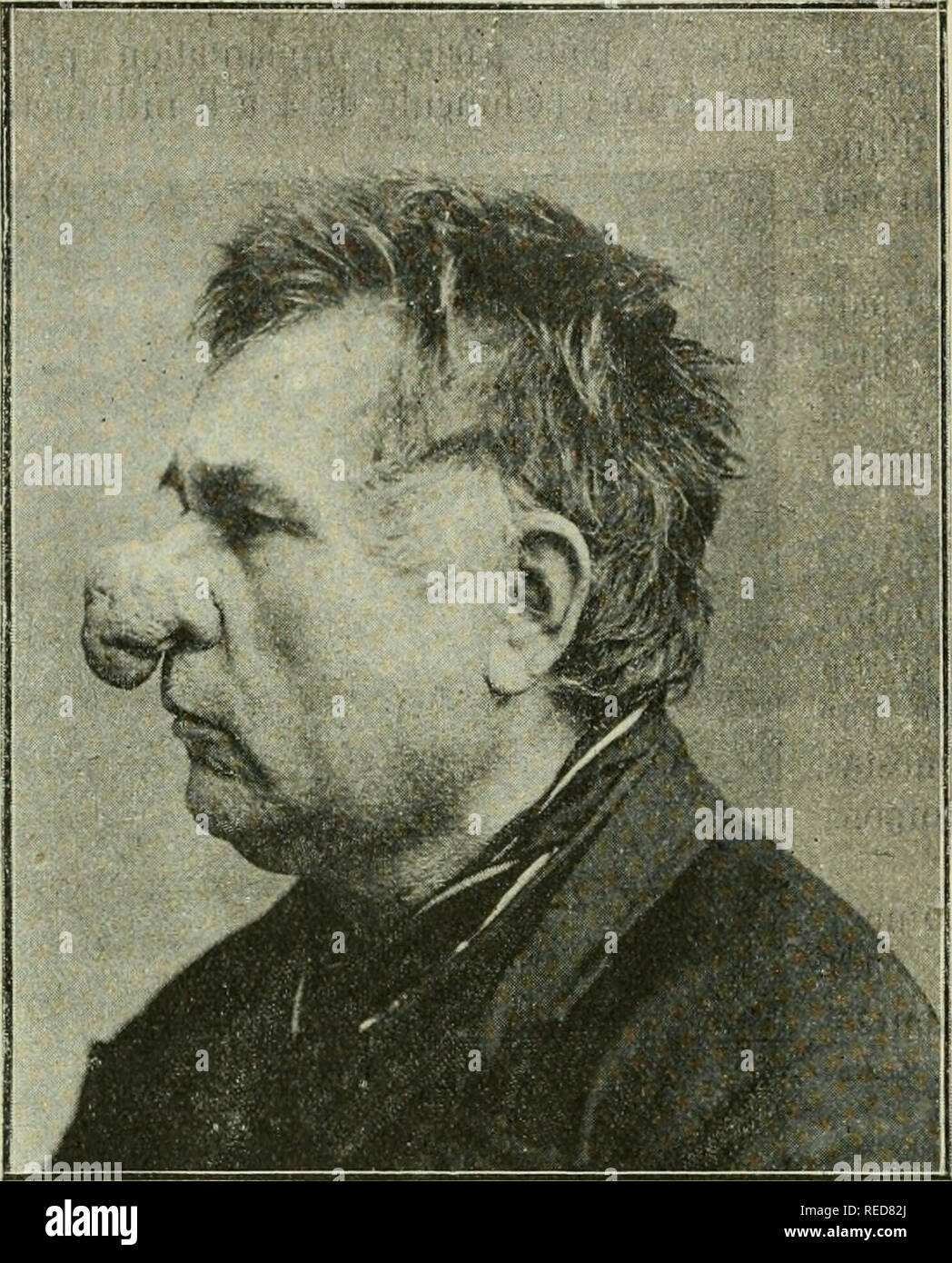 . Compte rendu. Science; Science -- Congresses. 762 SCIENCES MÃDICALES ...