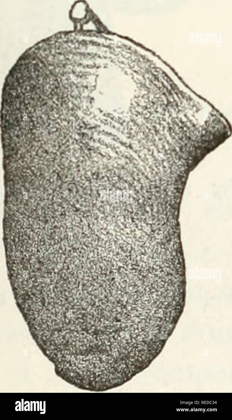 Moignons de bras hi-res stock photography and images - Alamy