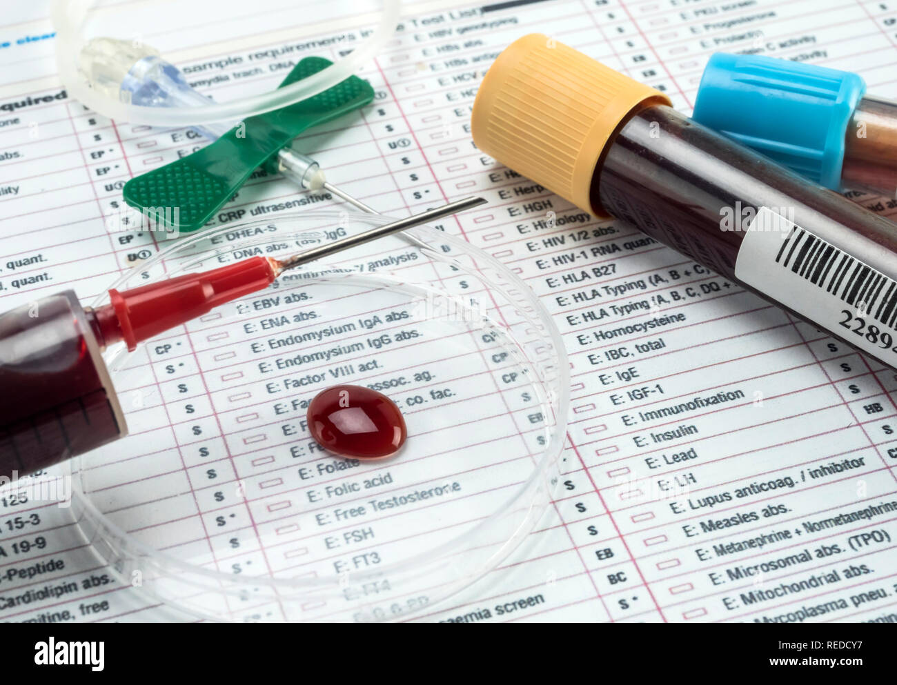 Microbiology shigella agar hi-res stock photography and images - Alamy