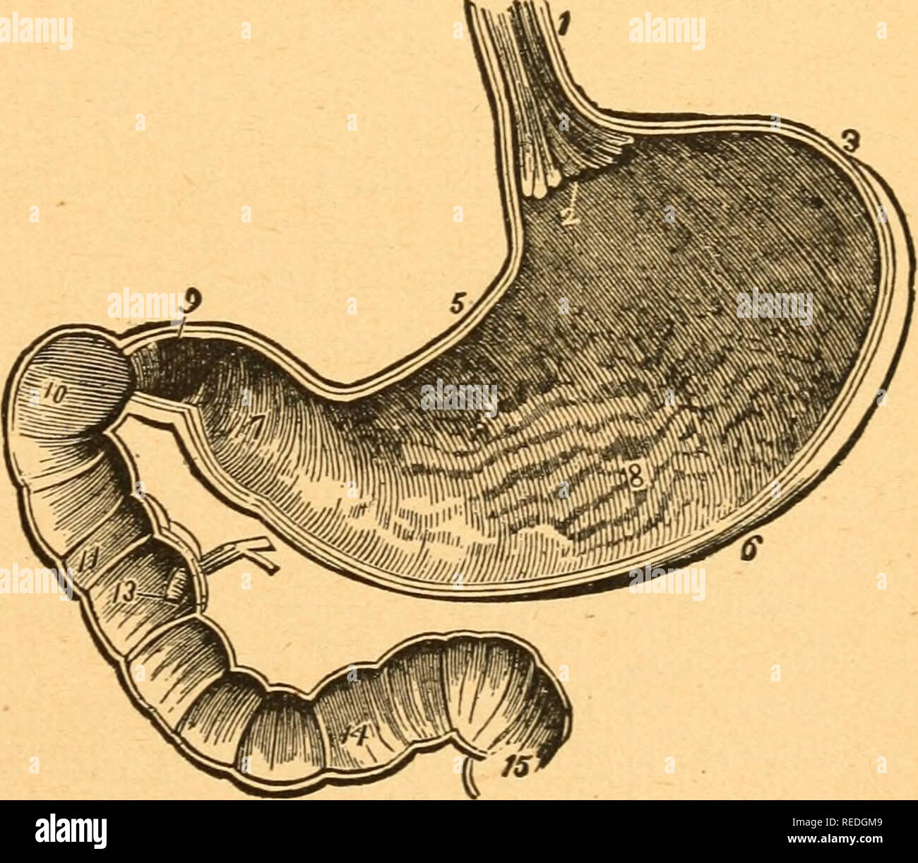 Tonsil membrane hi-res stock photography and images - Alamy