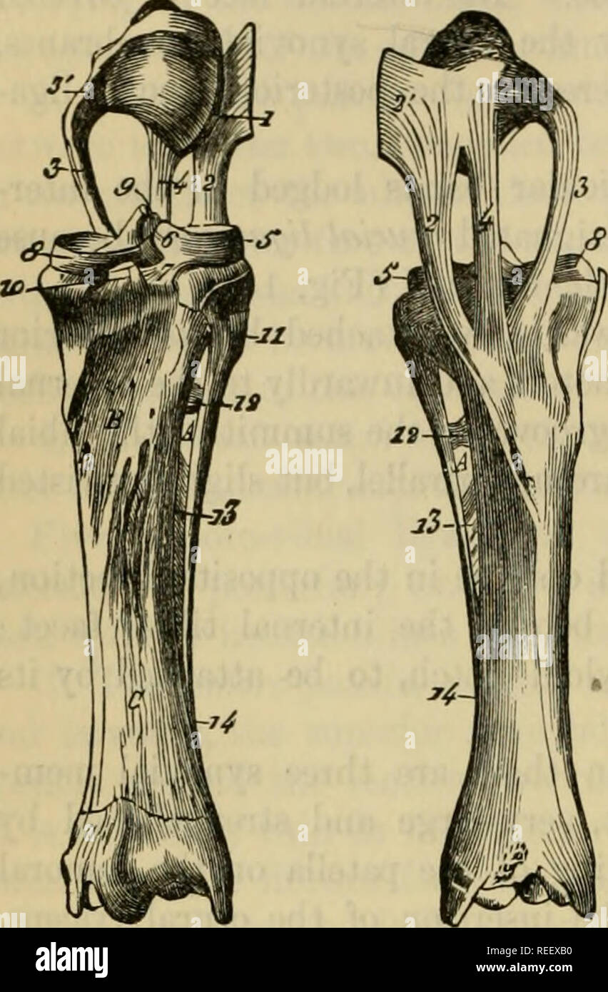 Placement tibia hi-res stock photography and images - Alamy
