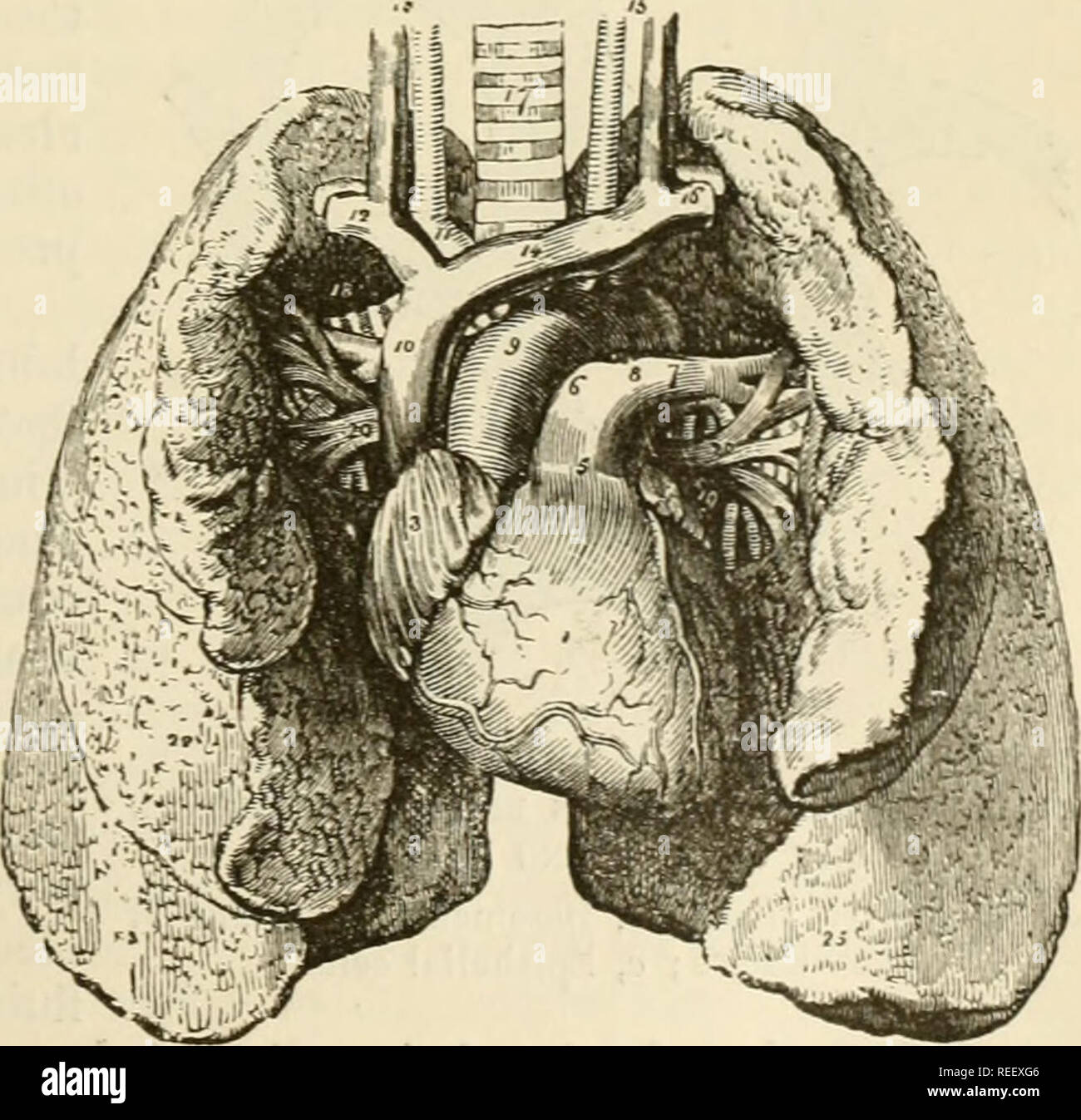 Arteria a vena hi-res stock photography and images - Alamy