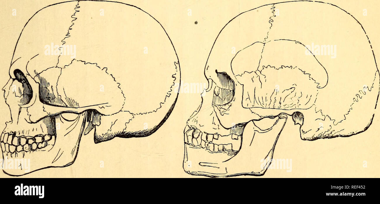 Half skull with brain hi-res stock photography and images - Alamy