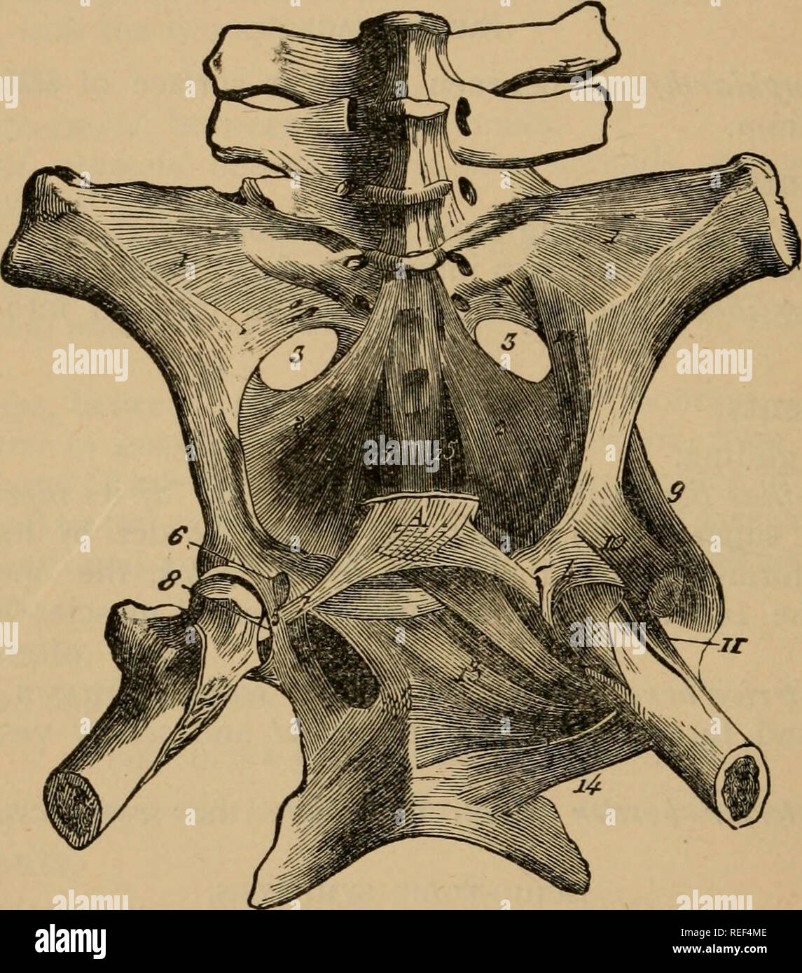 Head Of Femur Band