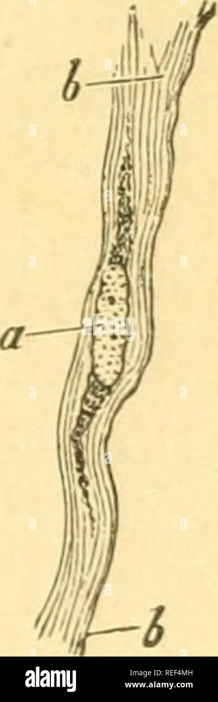 Cartilage tissue in the ear hi-res stock photography and images - Alamy