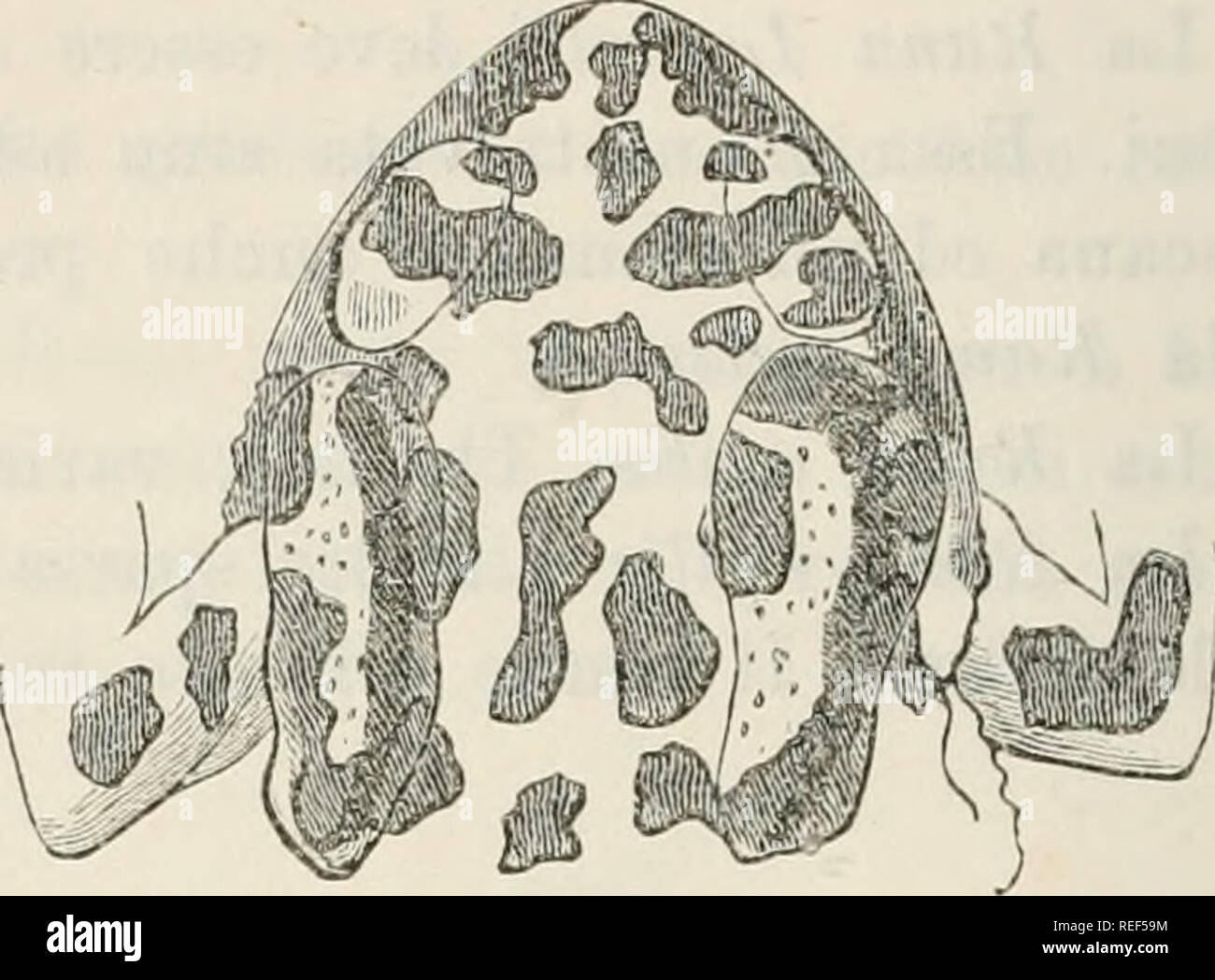 Tubercolo hi-res stock photography and images - Alamy