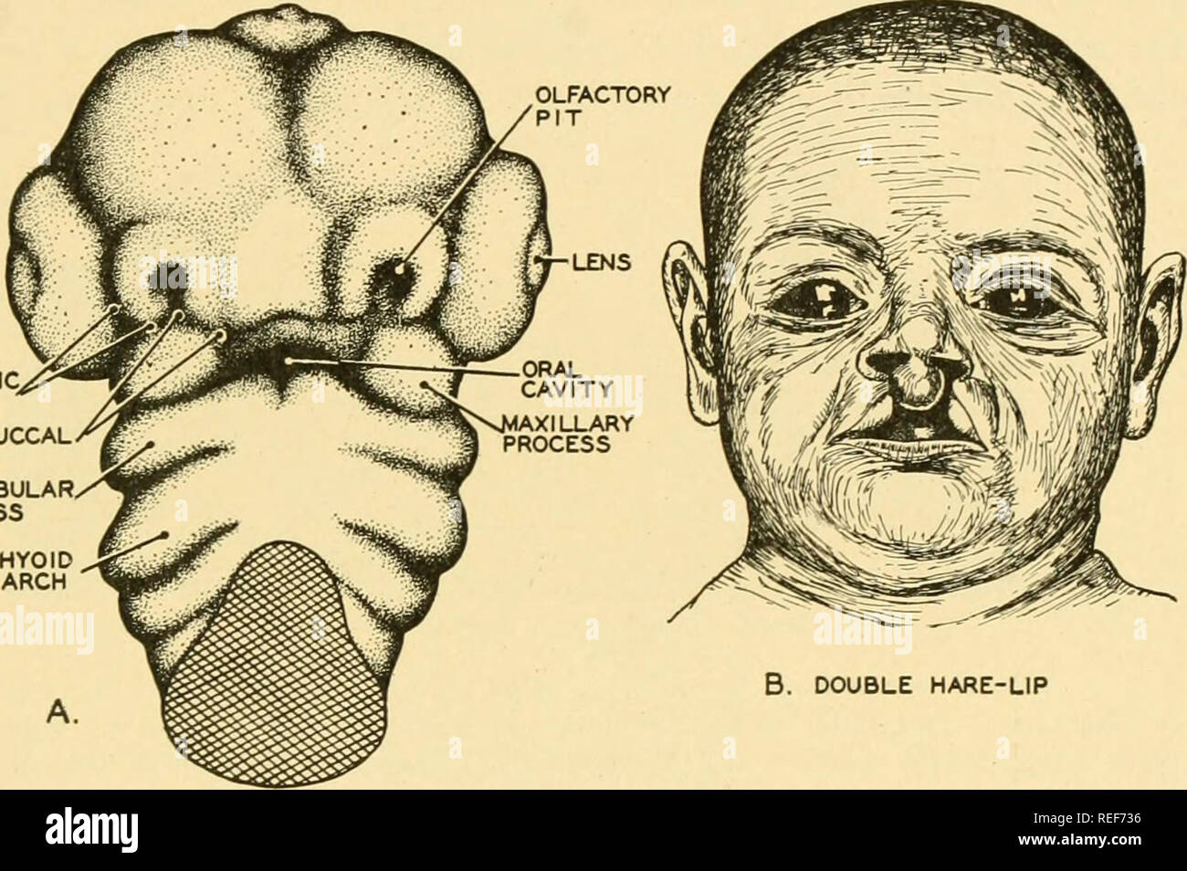 Choanae hi-res stock photography and images - Alamy
