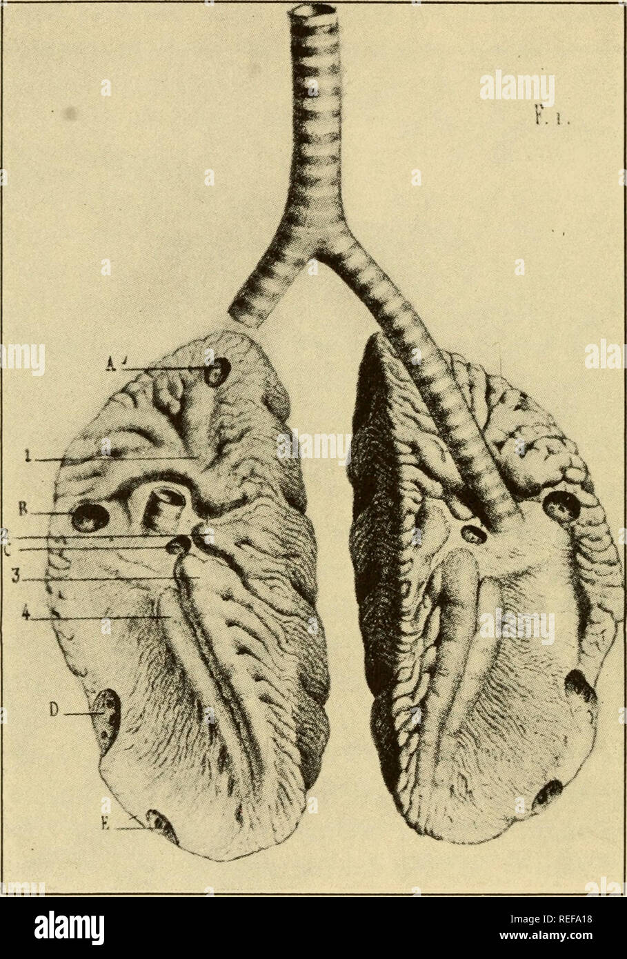 Alveoli air sacs hi-res stock photography and images - Alamy