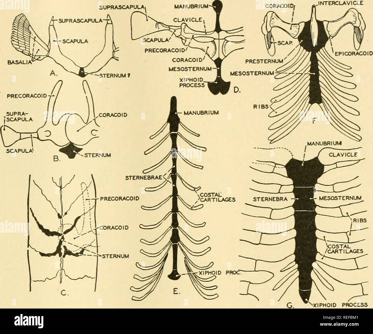 Posterior fusion hi-res stock photography and images - Alamy