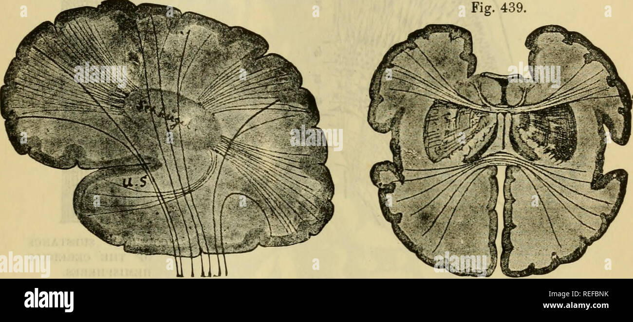 Corpus callosum hi-res stock photography and images - Alamy