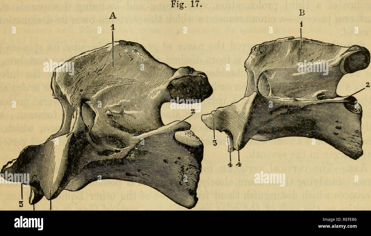 Transverse processes of cervical vertebrae hi-res stock photography and ...