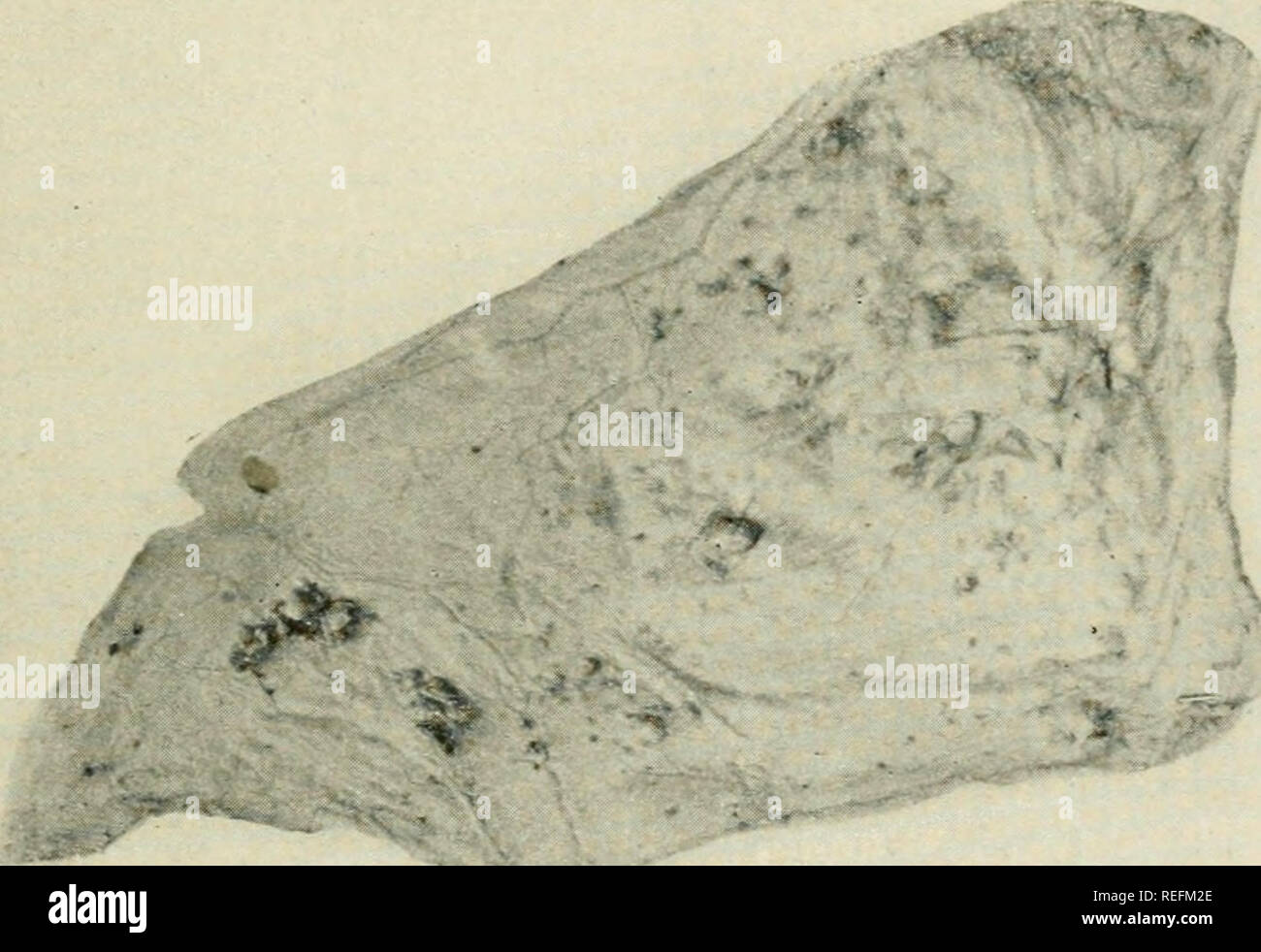 Tapeworm Segment High Resolution Stock Photography and Images - Alamy