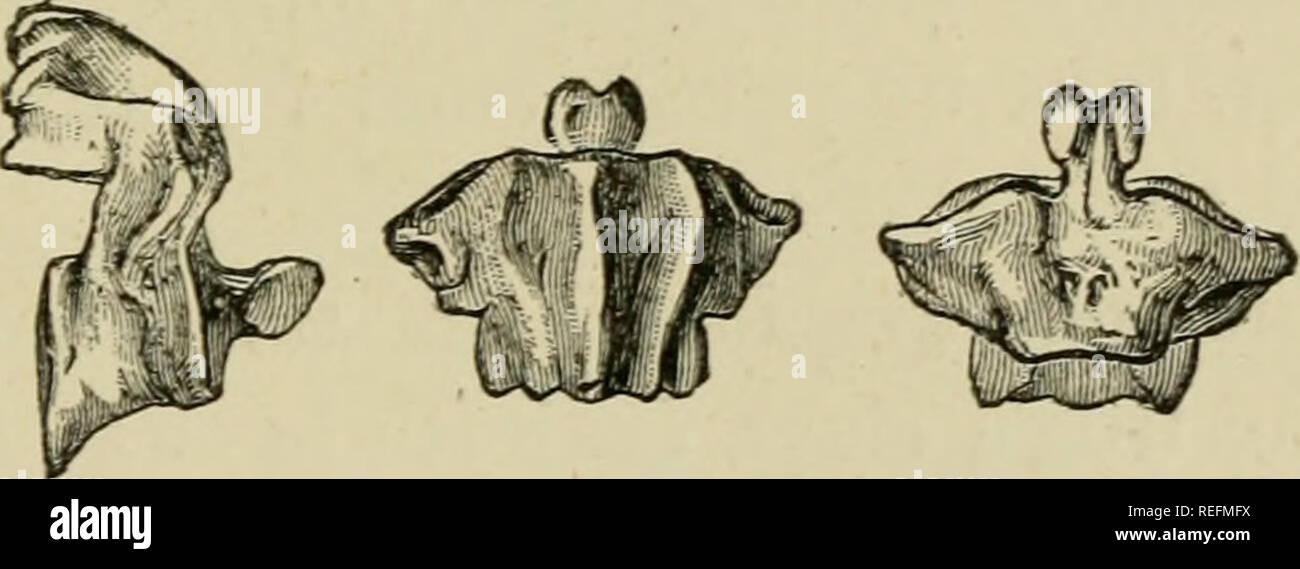Vertebra atlas y axis hi-res stock photography and images - Alamy