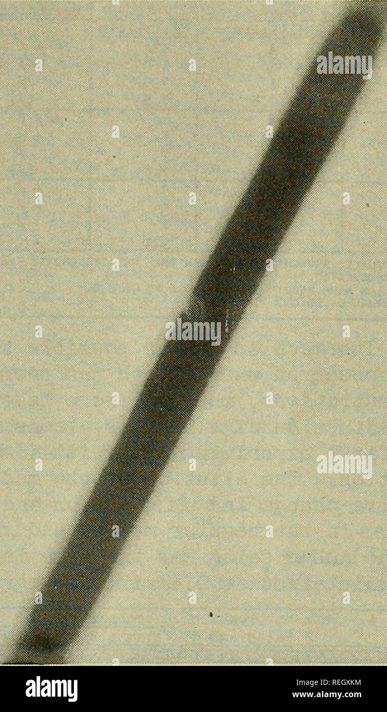 20 micrograms hi-res stock photography and images - Alamy