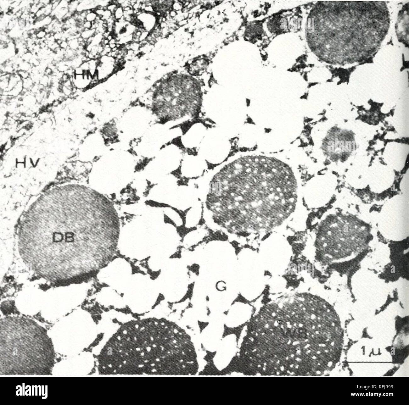 Glycogen granules micrograph hi-res stock photography and images - Alamy