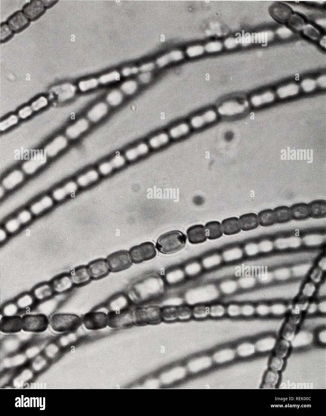 Anabaena Under Microscope Labeled