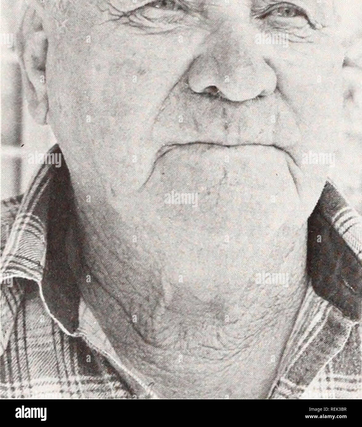 Blackbeard's head hi-res stock photography and images - Alamy