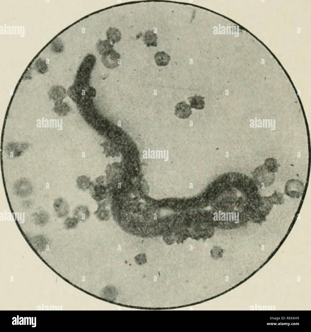 Trichina spiralis hi-res stock photography and images - Alamy