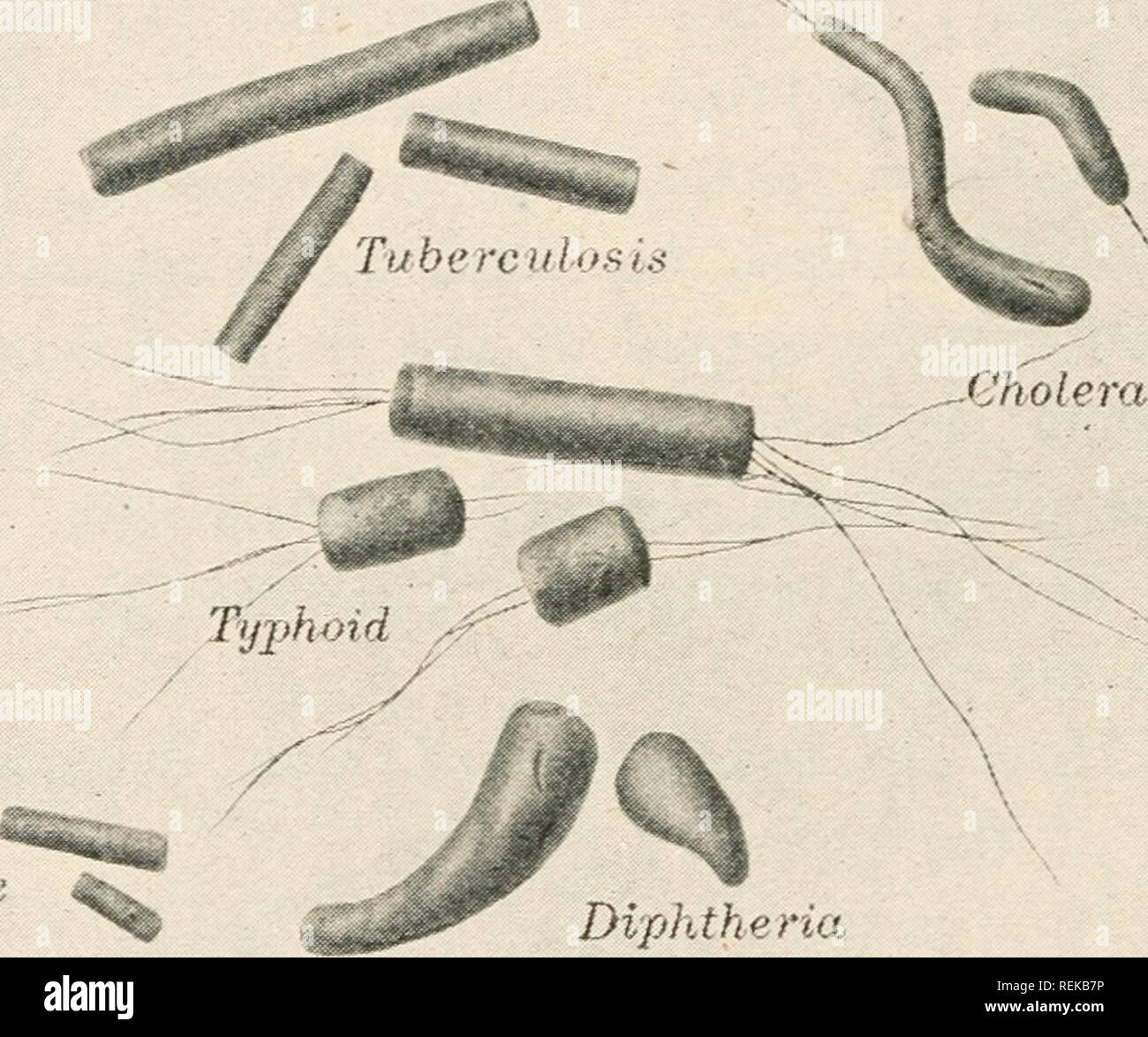 Smallpox skin lesions hi-res stock photography and images - Alamy