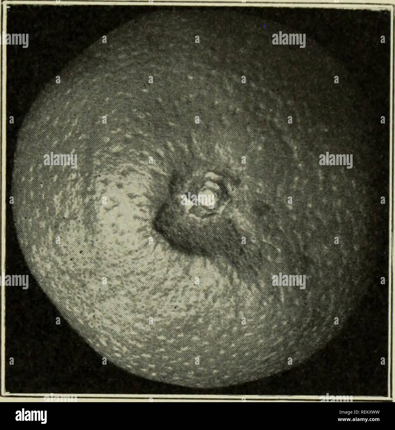 Navel spot hi-res stock photography and images - Alamy