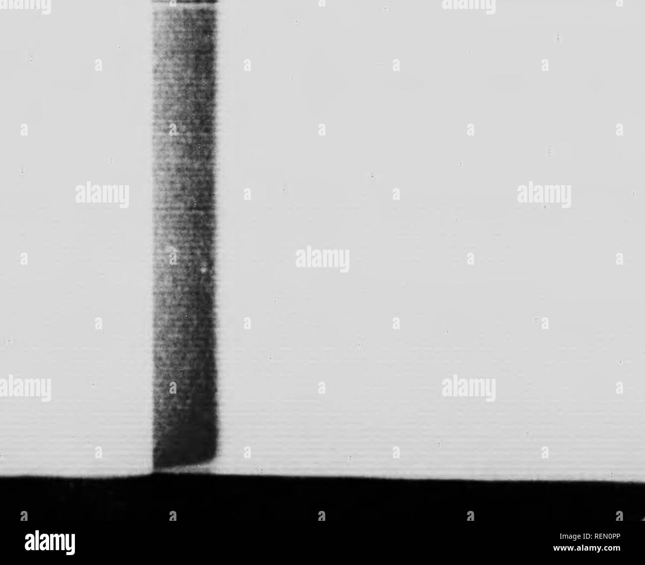 Human skin hair microscope Black and White Stock Photos & Images - Alamy