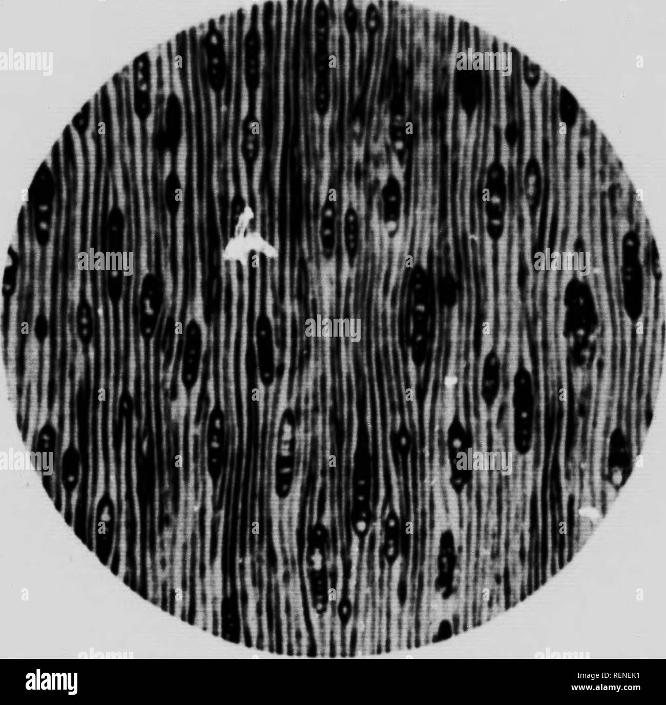 Manual x ray Black and White Stock Photos & Images - Alamy